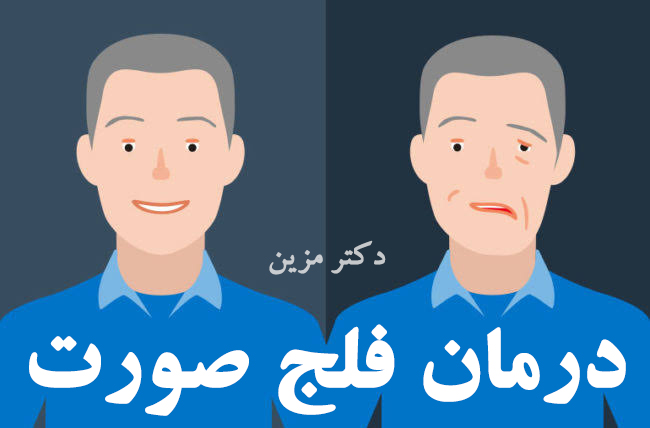 درمان قطعی فلج بلز با دارو، طب سوزنی و تمرین | سعید مزین